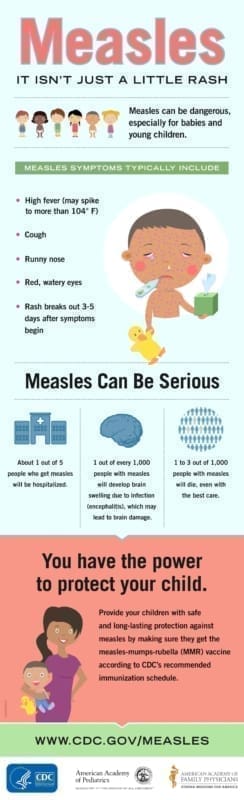 Measles: Symptoms and Treatment - Measles Vaccine